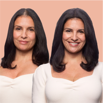 Toppers for Hair | Premium Human Hair Toppers – Irresistible Me